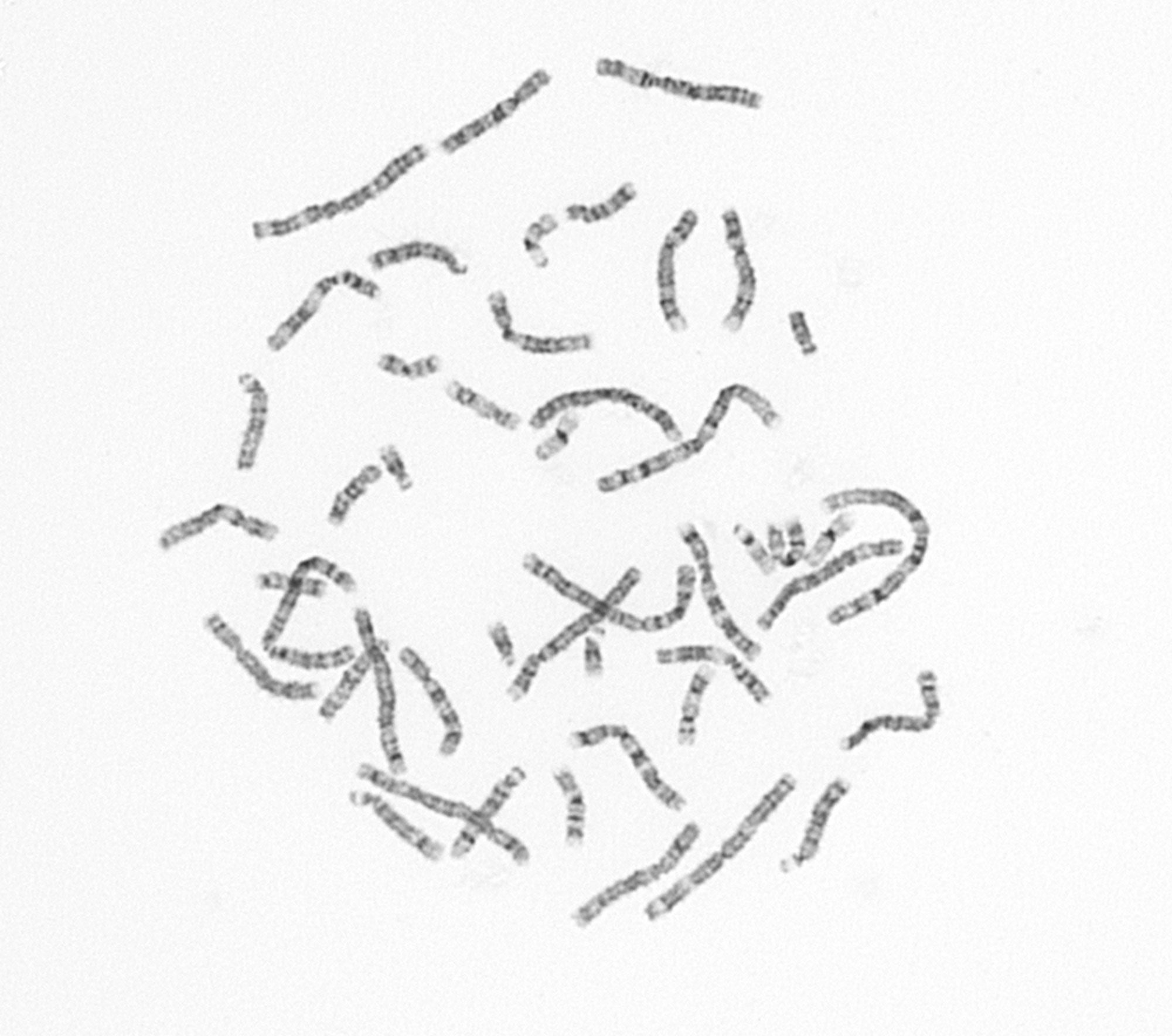 Karyotyping | BioDot