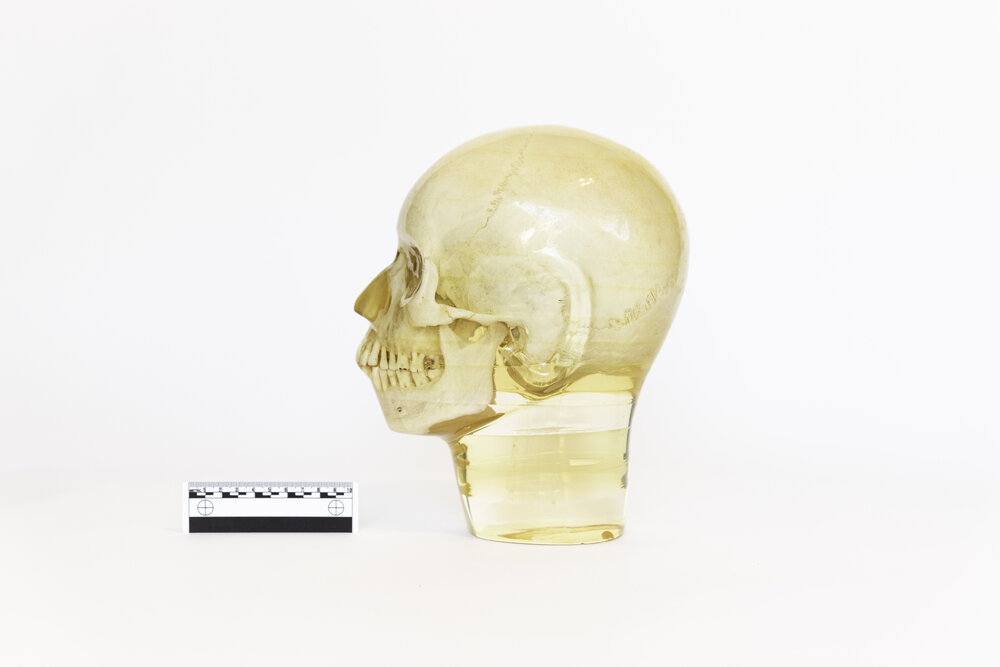Phantom Skull | JonsBones: Responsibly Sourced Human Osteology