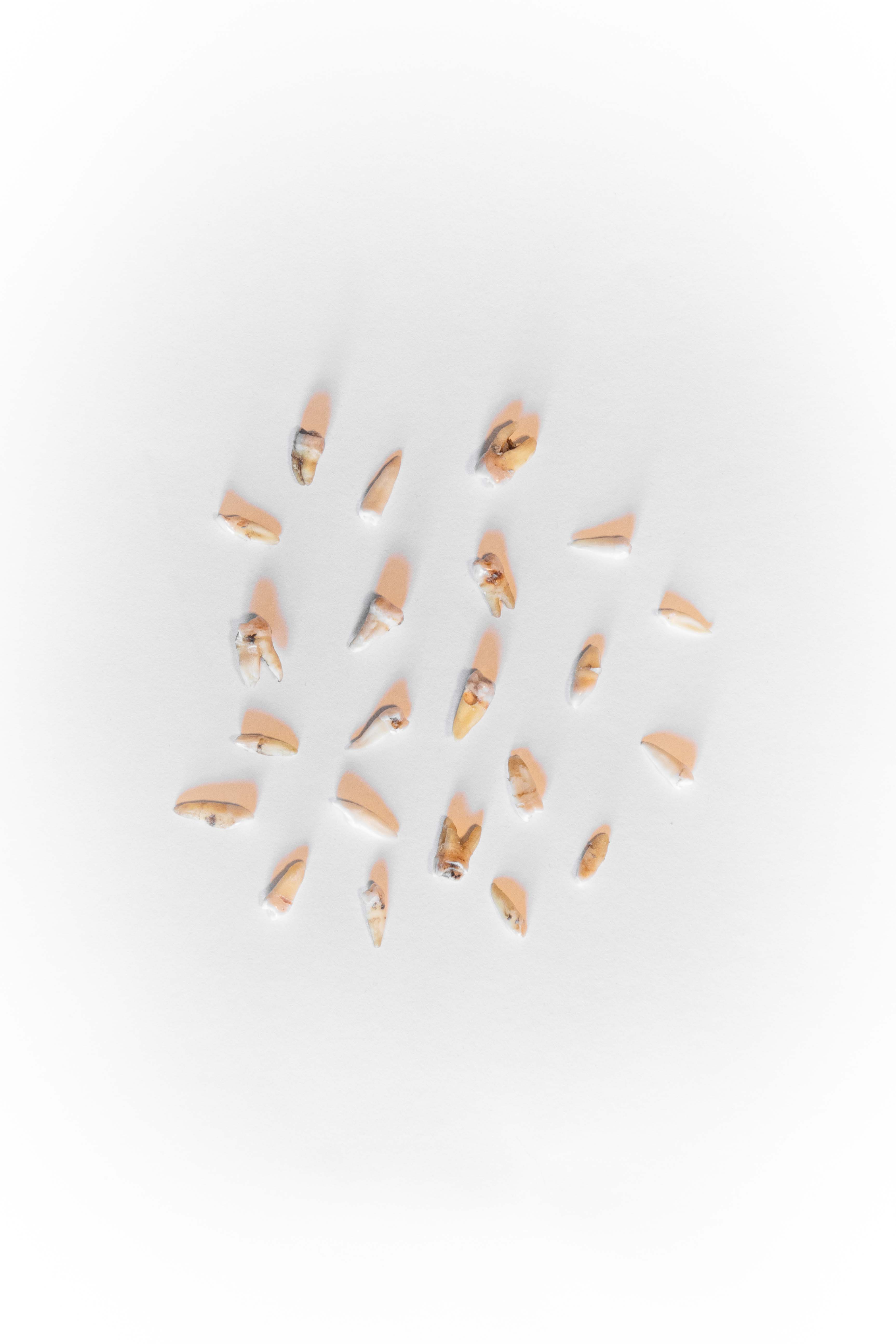 Teeth | JonsBones: Responsibly Sourced Human Osteology