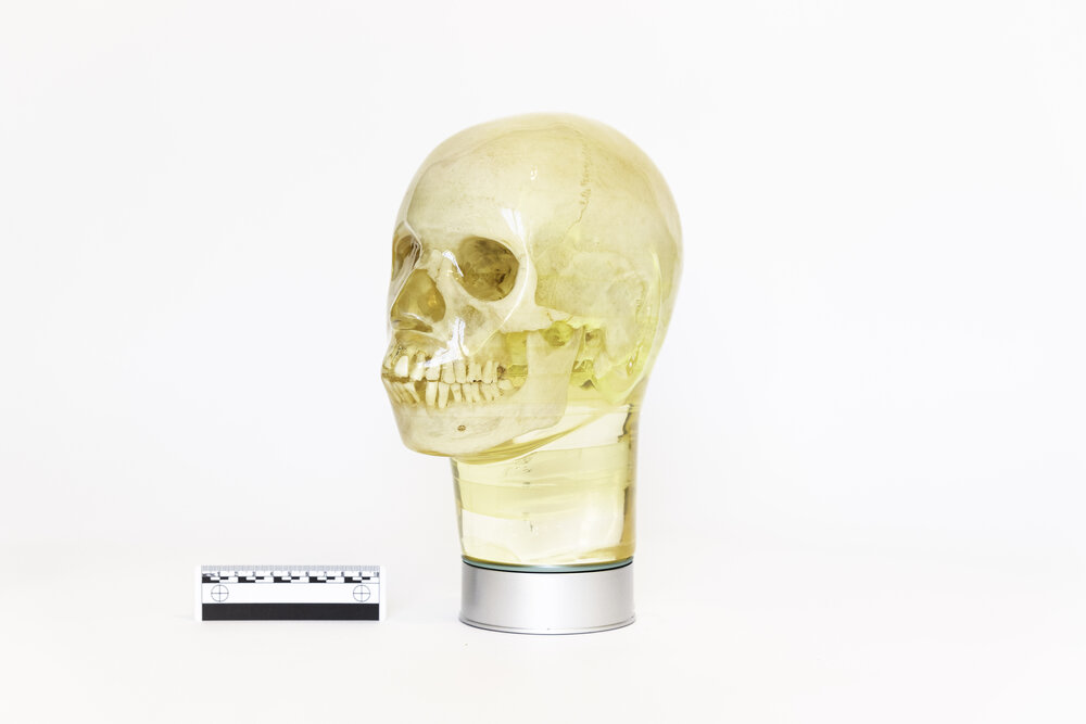 Phantom Skull | JonsBones: Responsibly Sourced Human Osteology