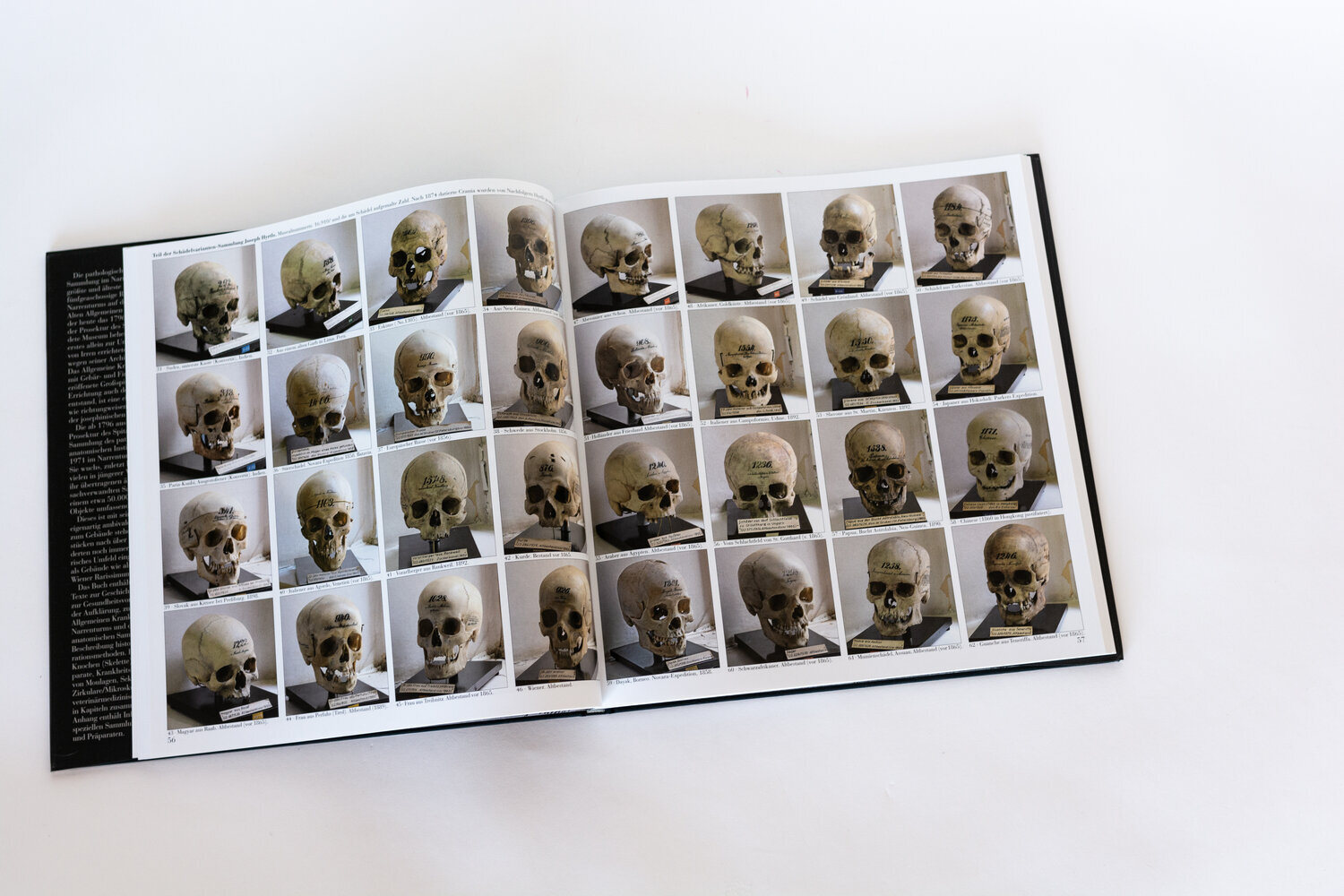 "The Fool's Tower" Vienna Pathological-Anatomical Museum | JonsBones ...