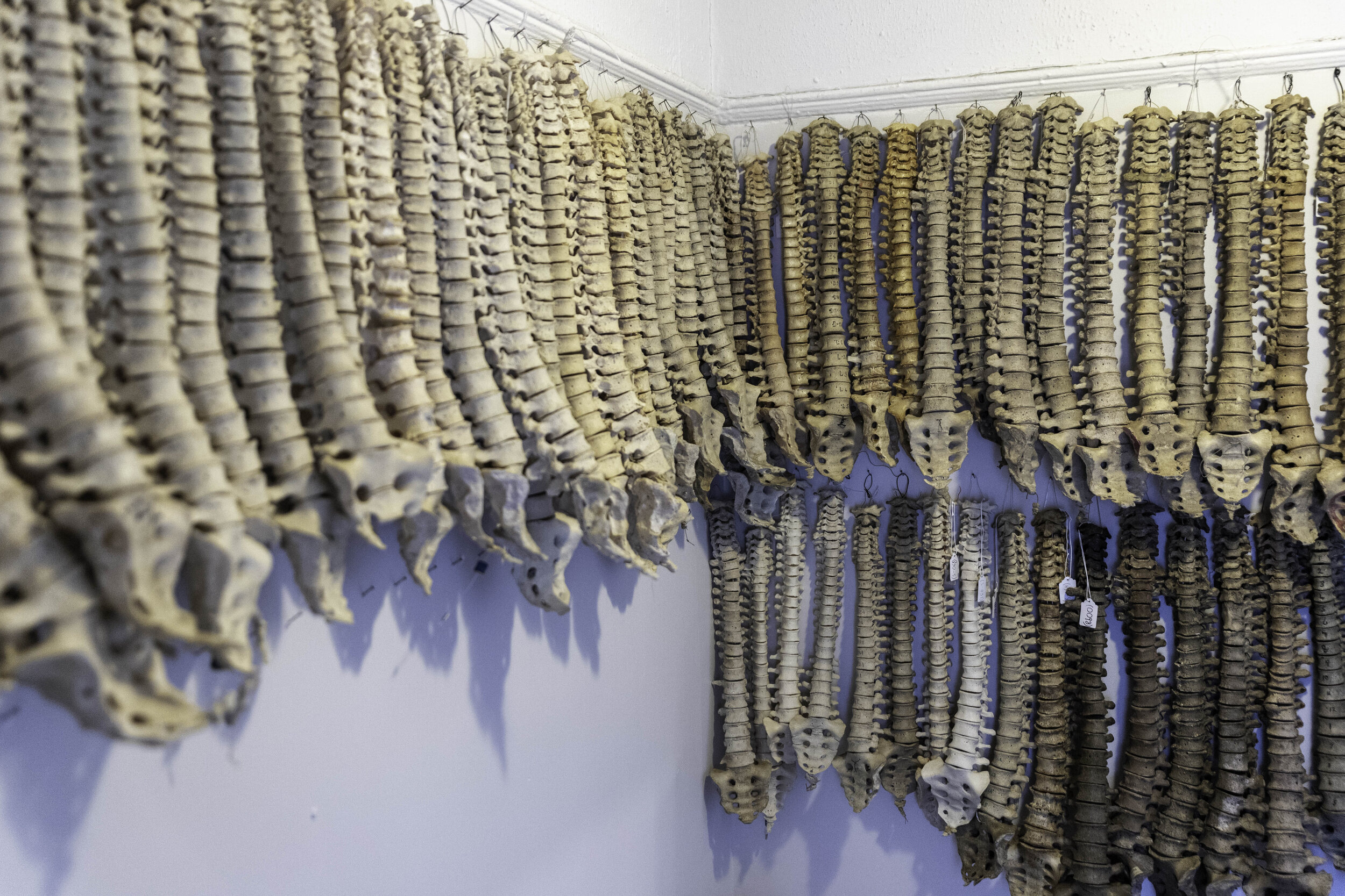 So What’s Up With the Spine Wall? | JonsBones: Osteology Education