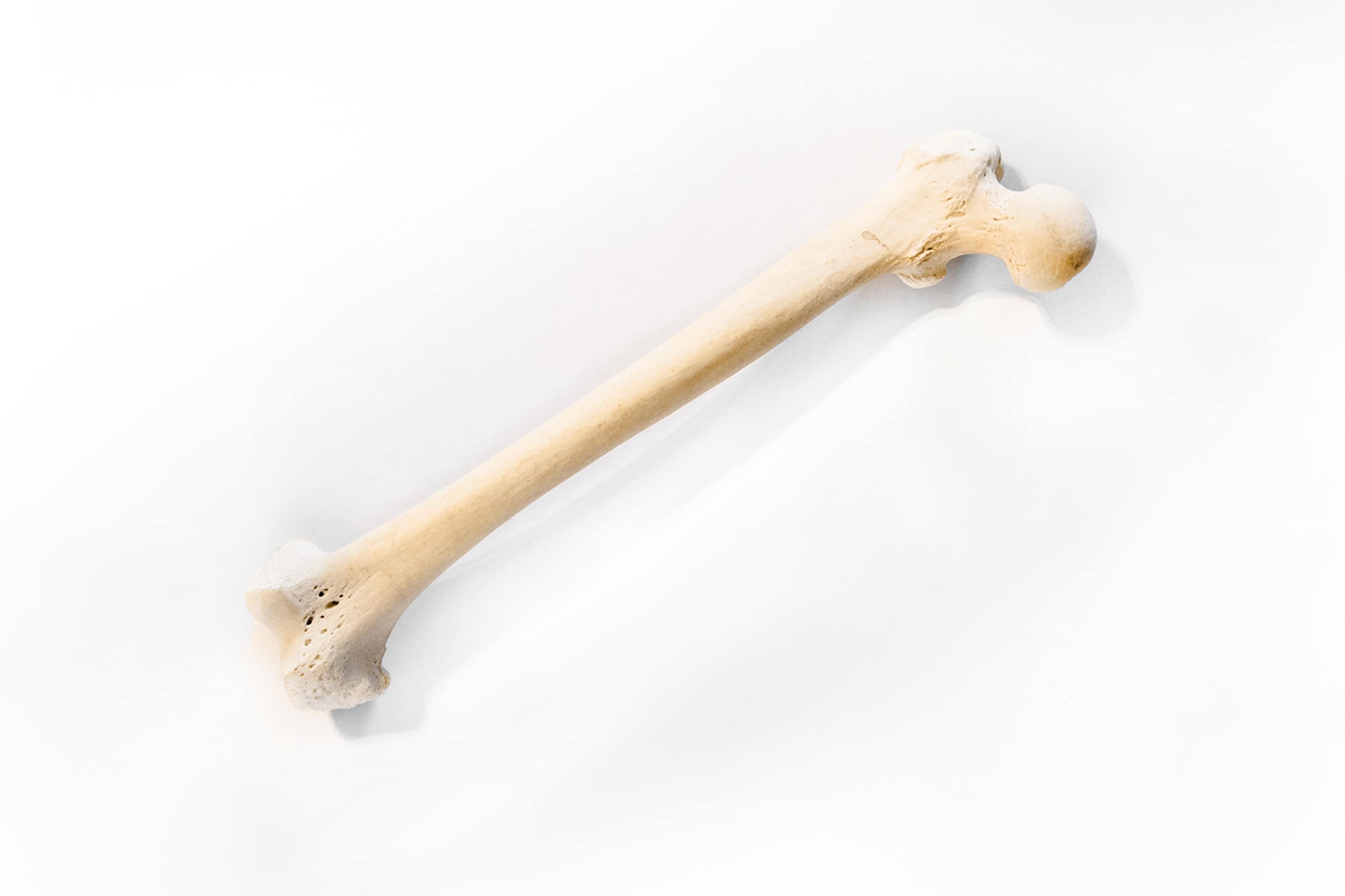Femurs With Light Patina | JonsBones: Responsibly Sourced Human Osteology