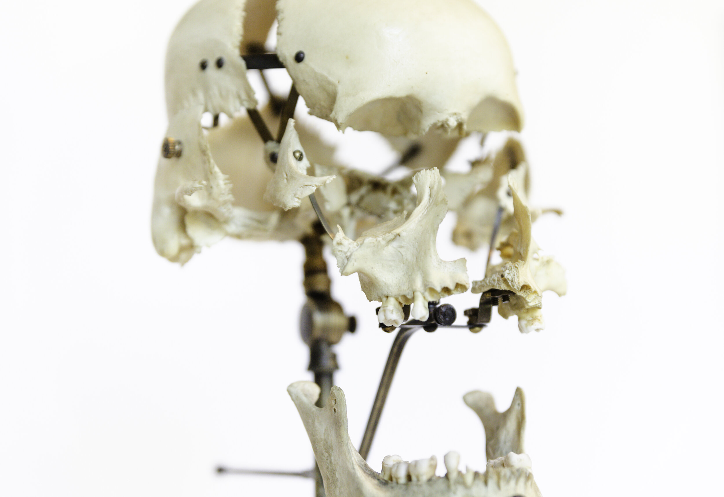 What is an exploded skull? | JonsBones: Osteology Education