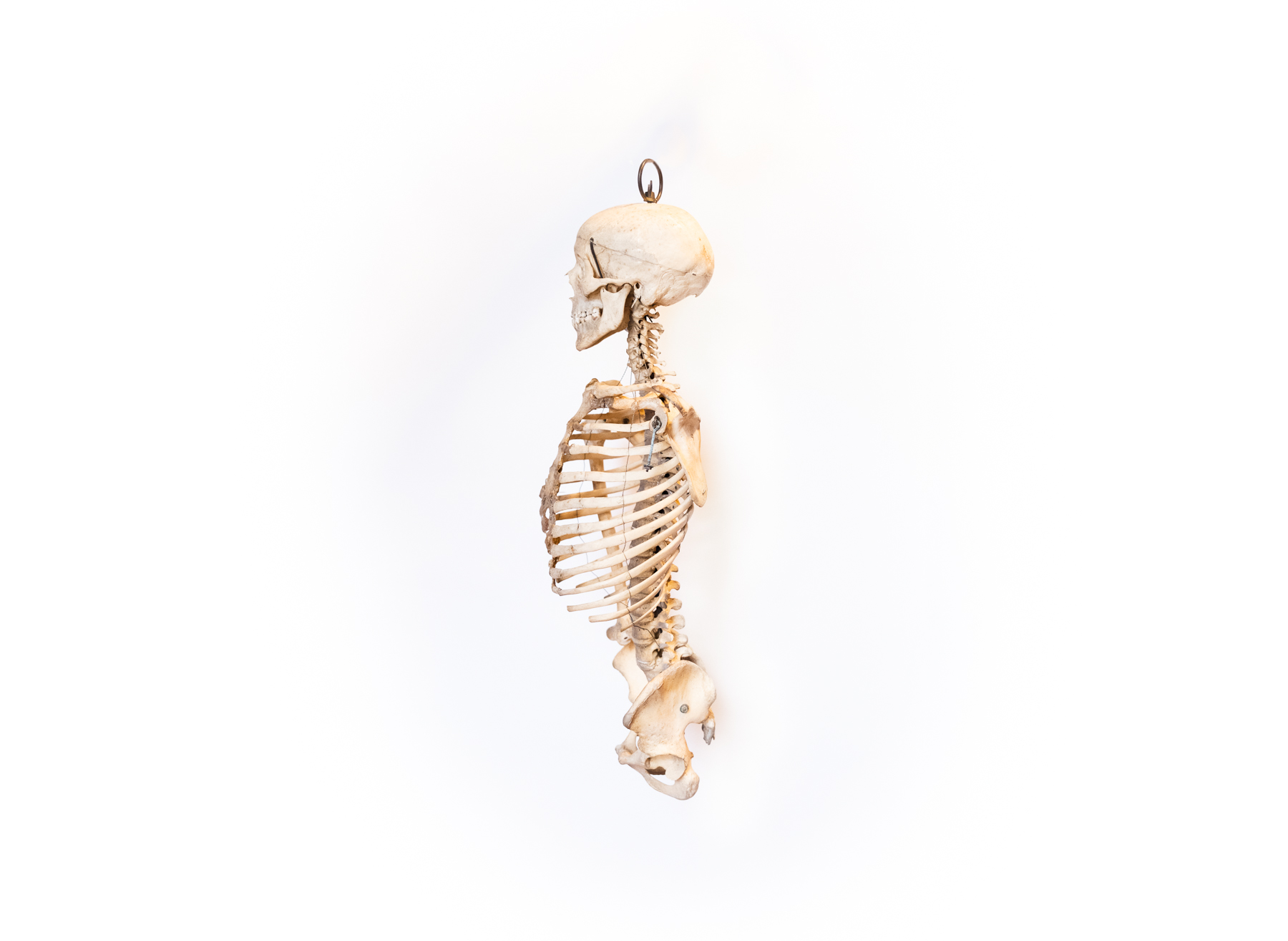 Oddfellows Medical Skeleton-Torso and Skull (0914) | JonsBones ...