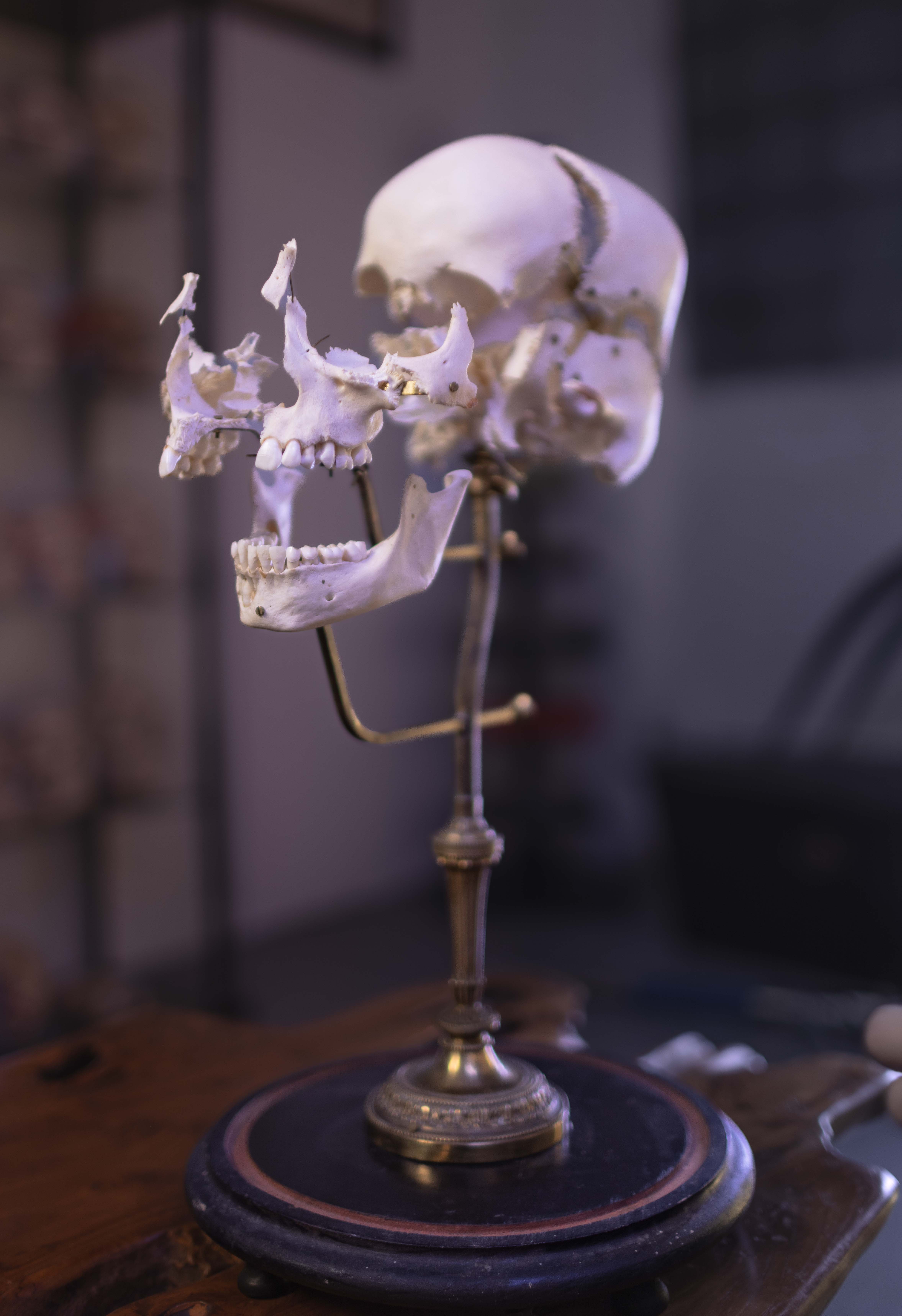 Medical Bones Versus Everything Else | JonsBones: Osteology Education