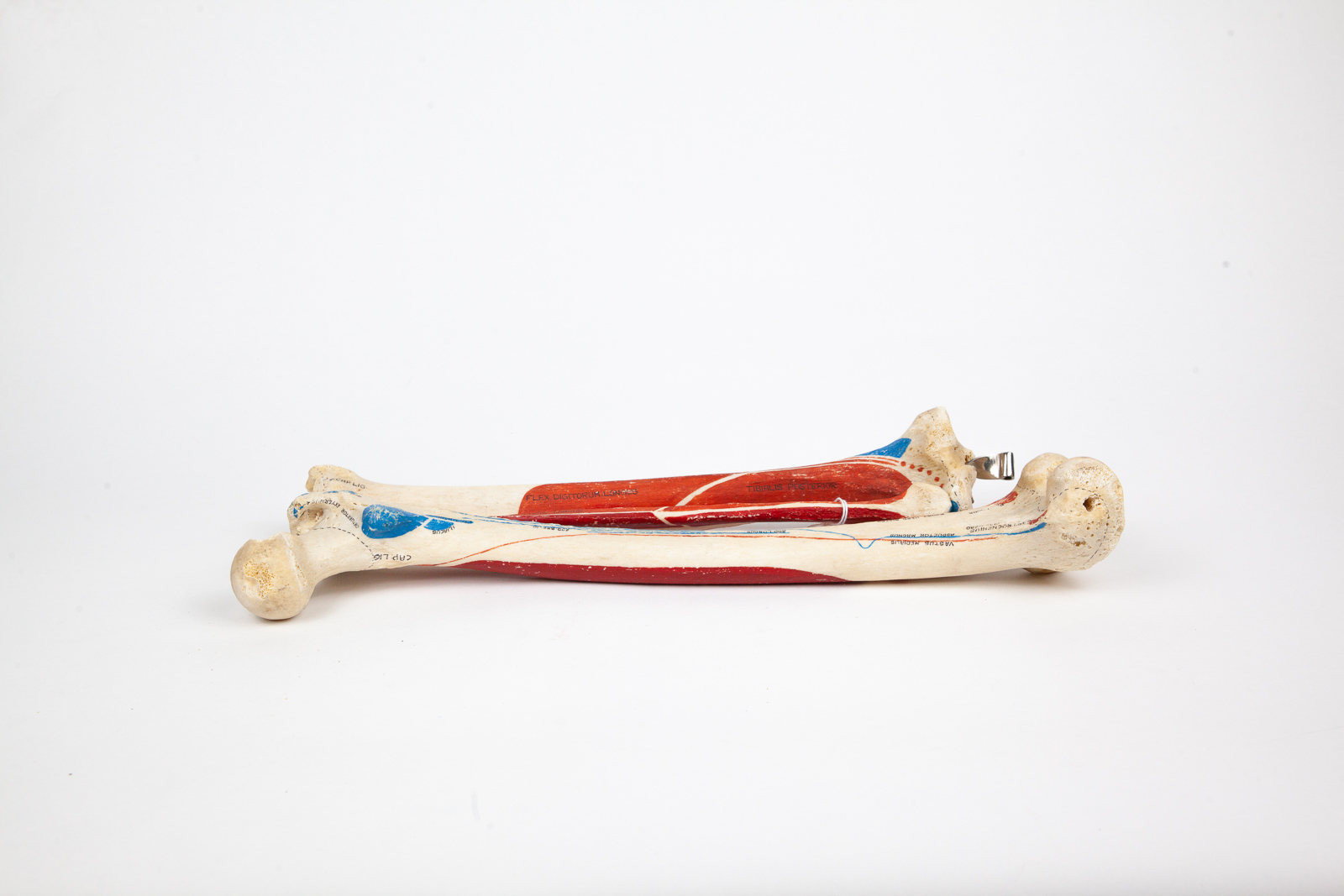 Femur Tibia & Fibula Articulation (004) | JonsBones: Responsibly ...