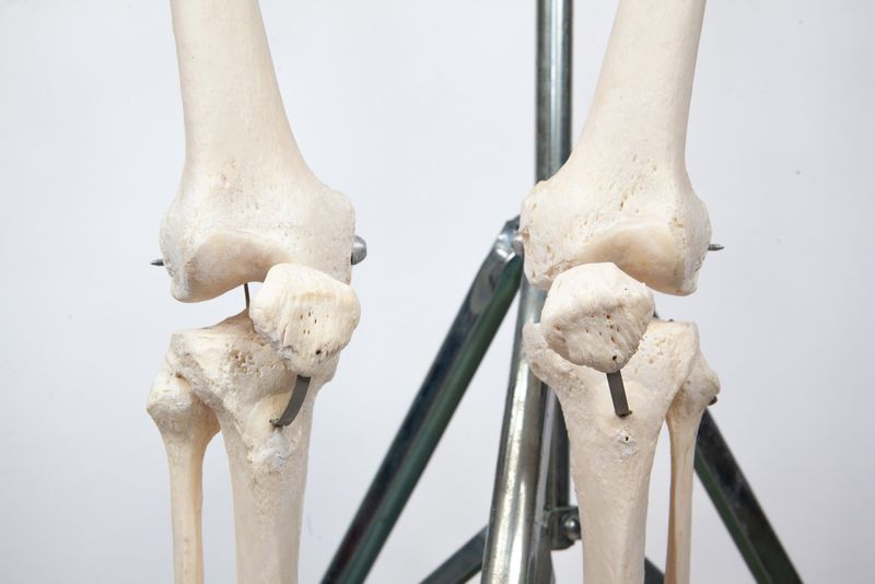 Articulated Human Skeleton (920) | JonsBones: Responsibly Sourced Human ...