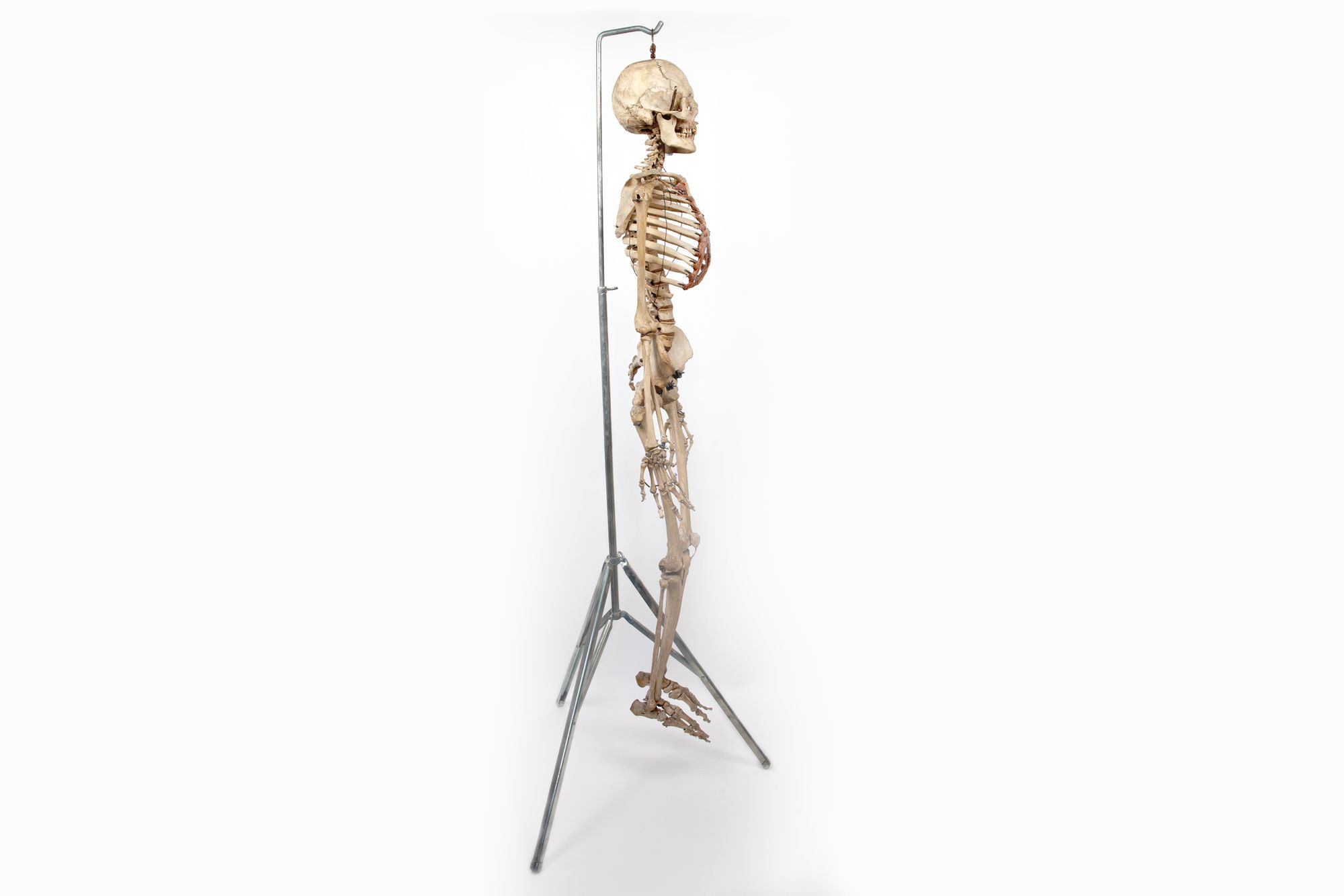 Antique Adam, Rouilly Articulated Skeleton (0923) | JonsBones ...