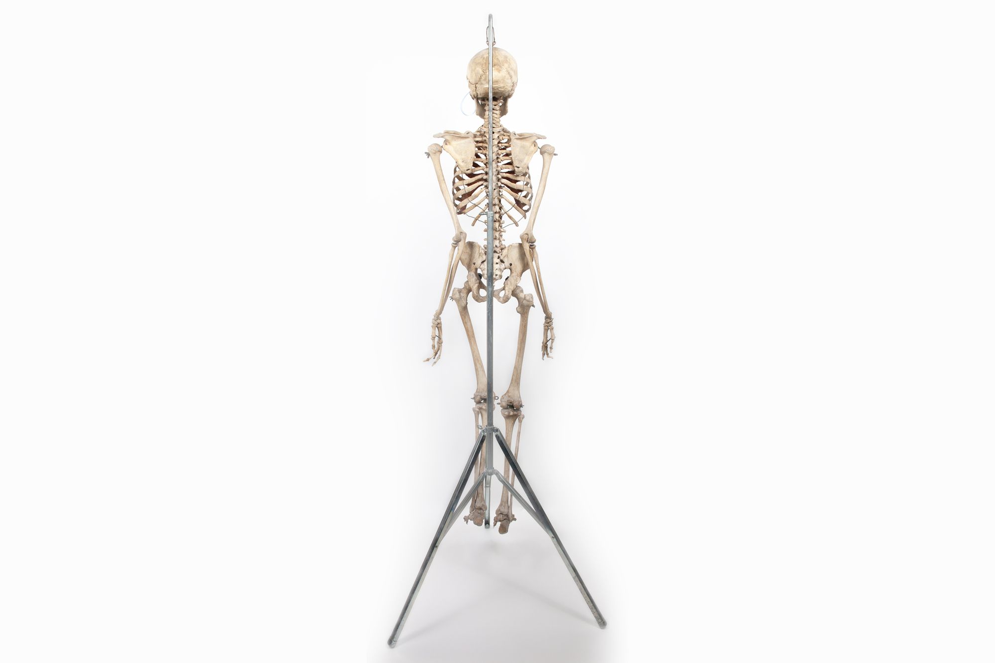Antique Adam, Rouilly Articulated Skeleton (0923) | JonsBones ...