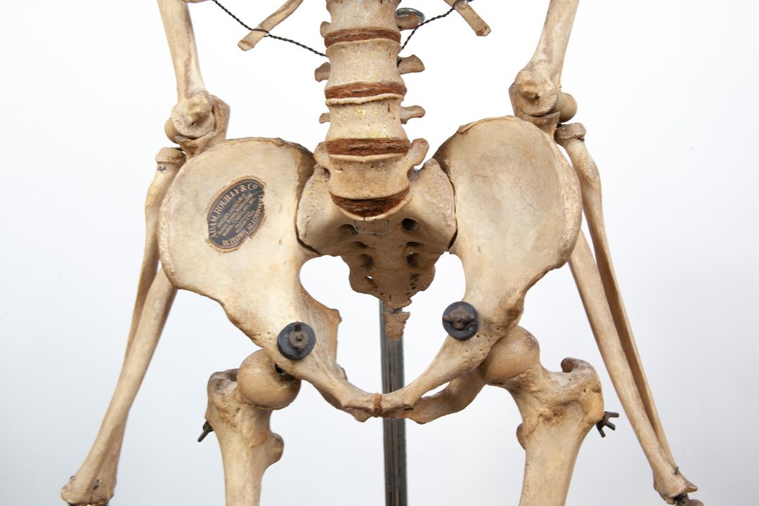 Antique Adam, Rouilly Articulated Skeleton (0923) | JonsBones ...