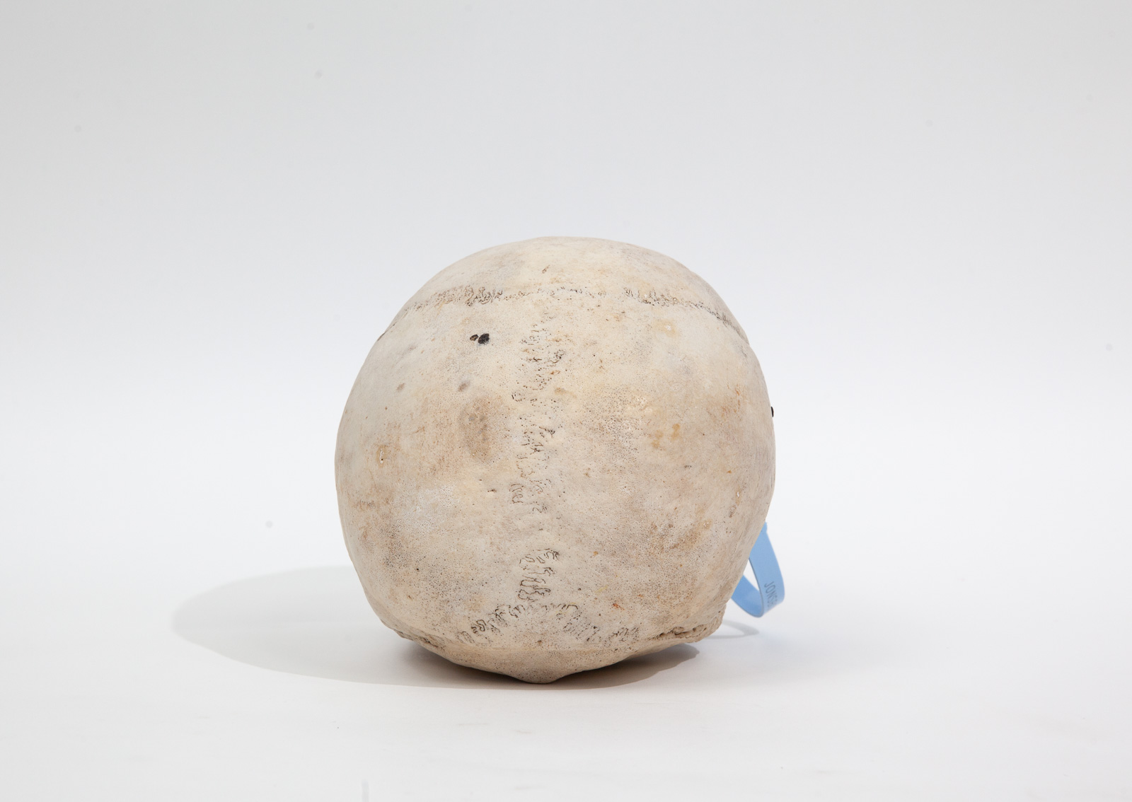 Trepanned Medical Skull (0228) | JonsBones: Responsibly Sourced Human ...