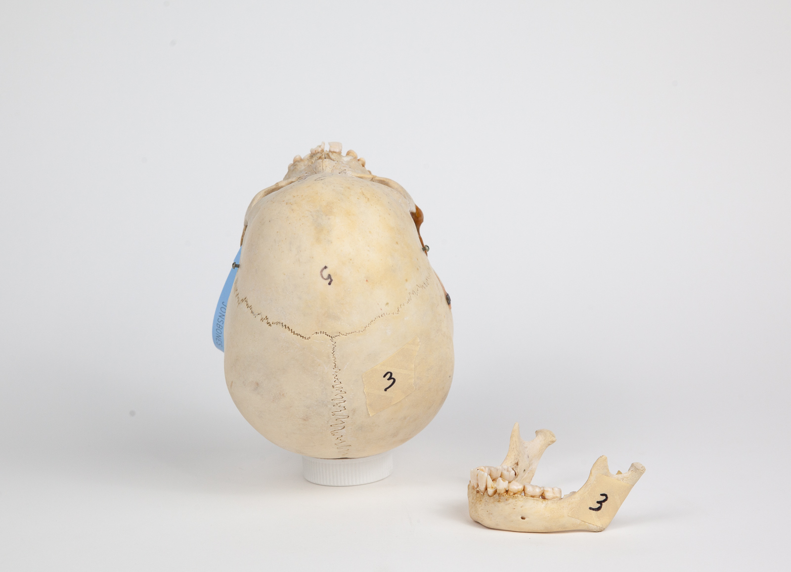 Pediatric Skull (0240) | JonsBones: Responsibly Sourced Human Osteology