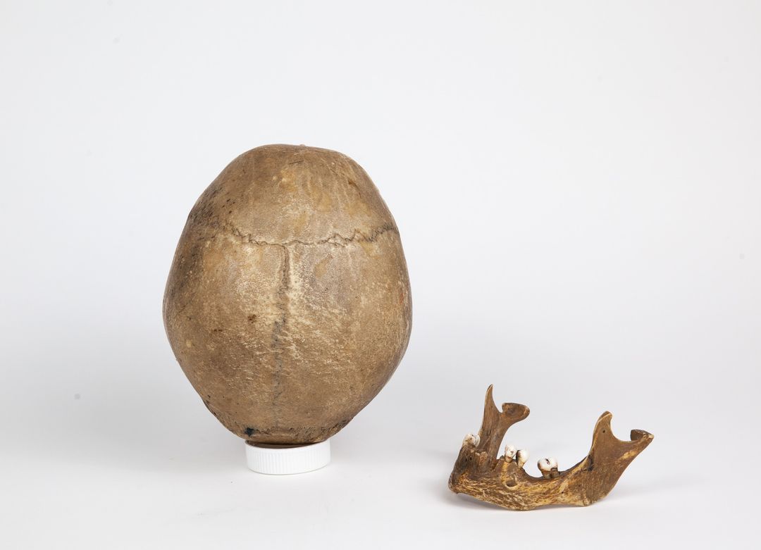 Half-Skeleton Bone Box (0244) | JonsBones: Responsibly Sourced Human ...