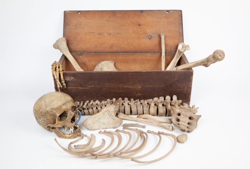 Half-Skeleton Bone Box (0244) | JonsBones: Responsibly Sourced Human ...