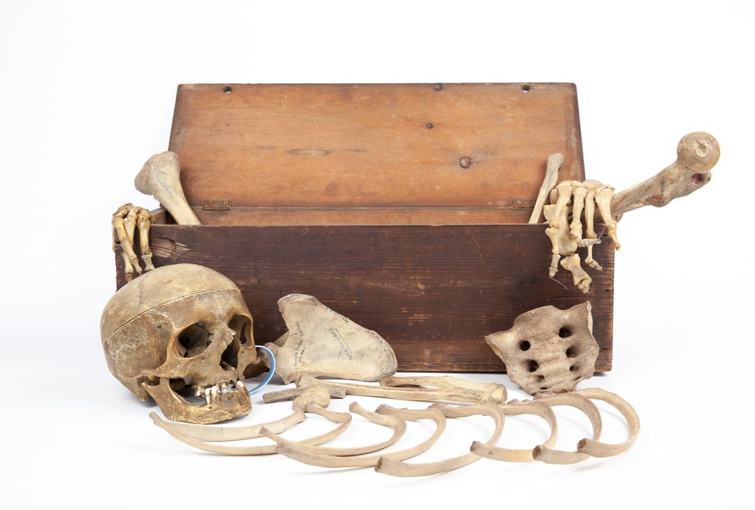 Half-Skeleton Bone Box (0244) | JonsBones: Responsibly Sourced Human ...