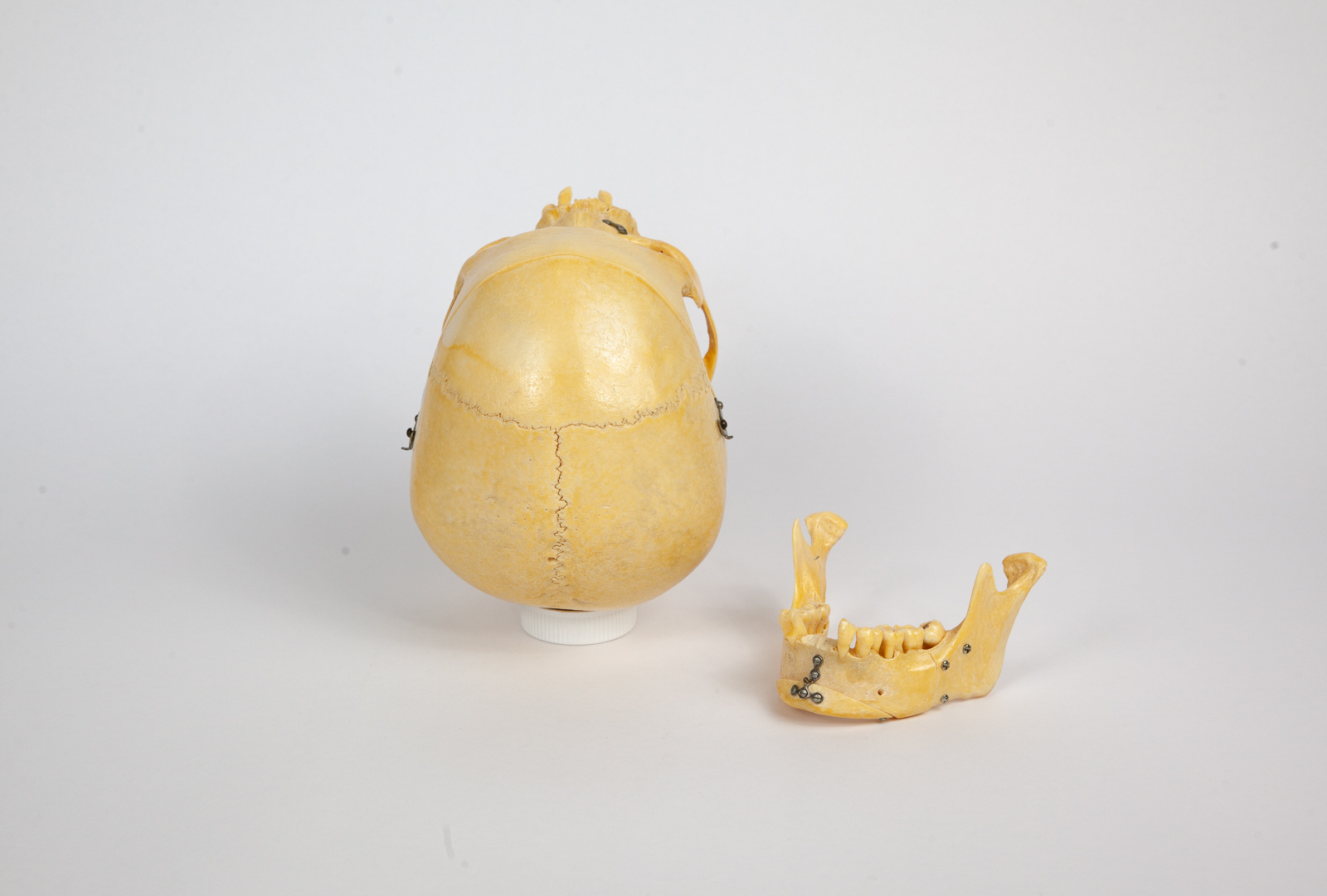 Skull with Facial Reconstruction (0249) | JonsBones: Responsibly ...