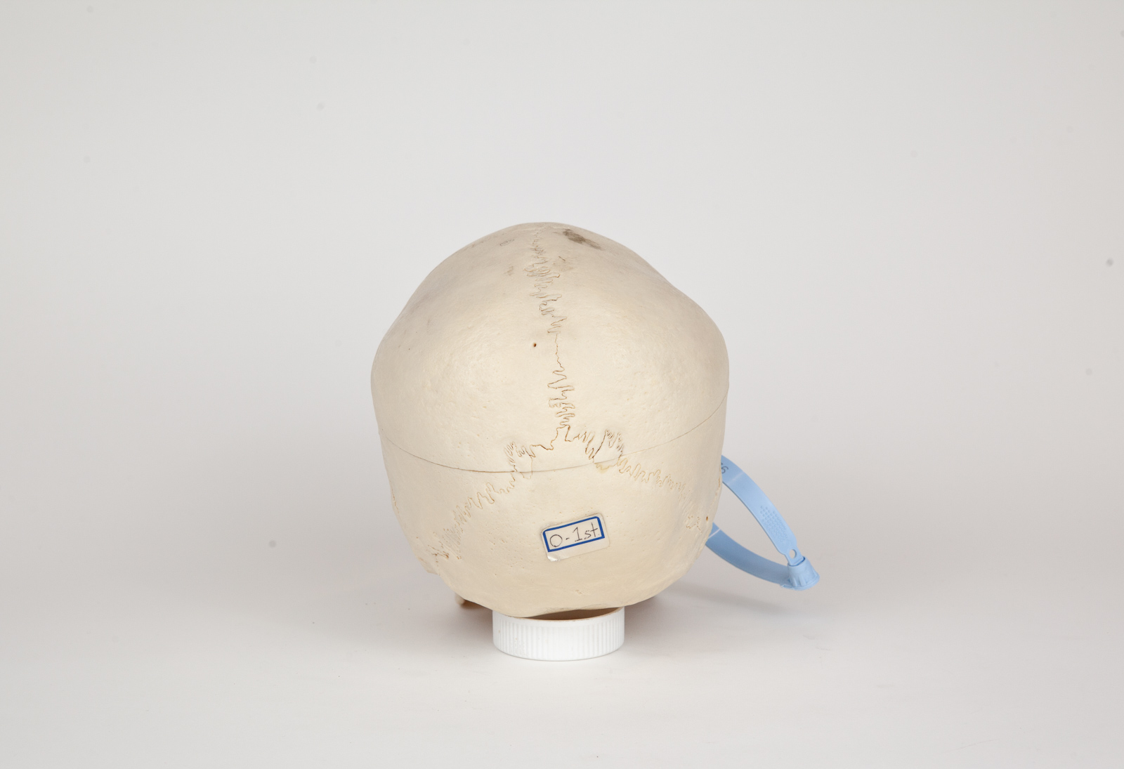 Medical Skull with Fused Atlas (0276) | JonsBones: Responsibly Sourced ...