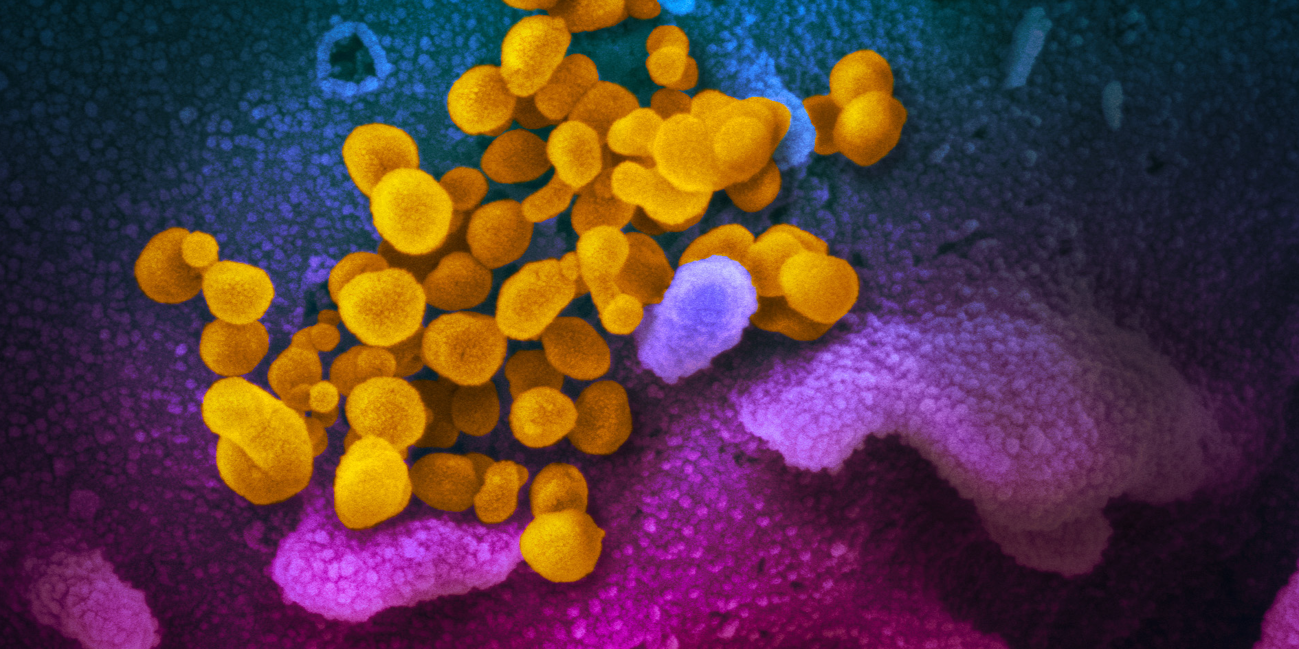 The COVID-19 research community page: a new approach for ResearchGate