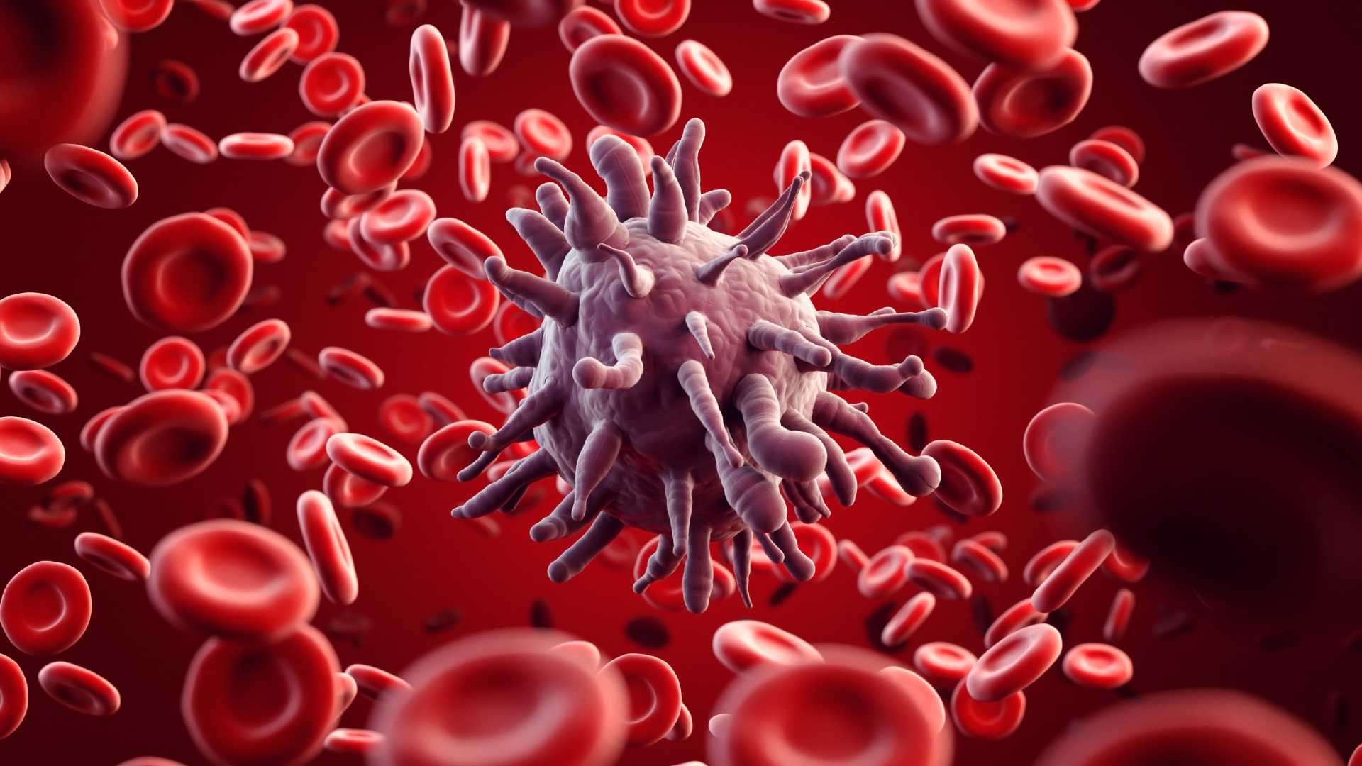 Infectologia: Sepse: causa, sinais e sintomas e tratamento