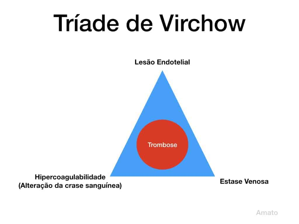 Cardiologia: Tromboembolismo venoso: o que é, como diagnosticar e tratar