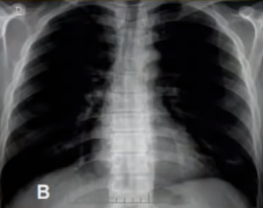 Radiologia e Diagnóstico por Imagem: Saiba o que deve ser analisado na ...