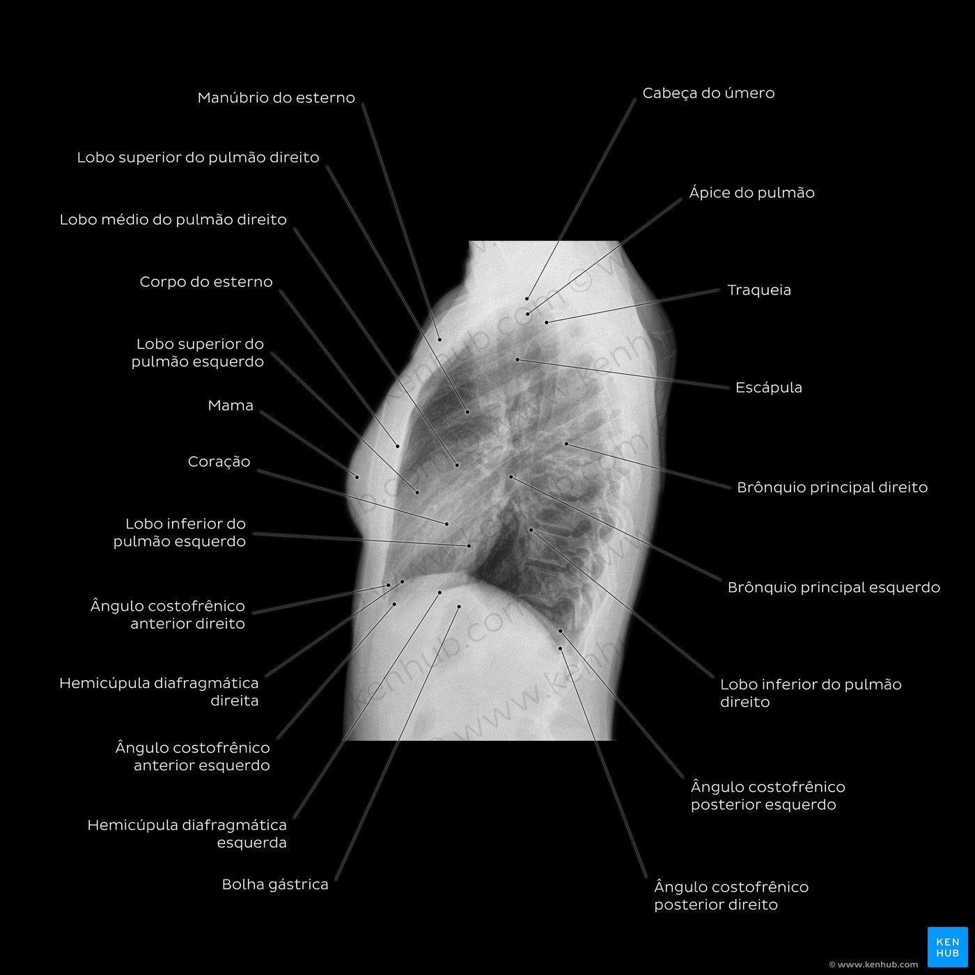 Radiologia e Diagnóstico por Imagem: Saiba o que deve ser analisado na ...