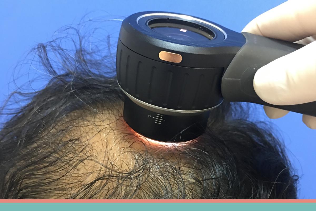 Dermatologia: Classificação das lesões elementares da pele