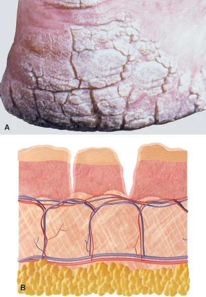 Dermatologia: Classificação das lesões elementares da pele