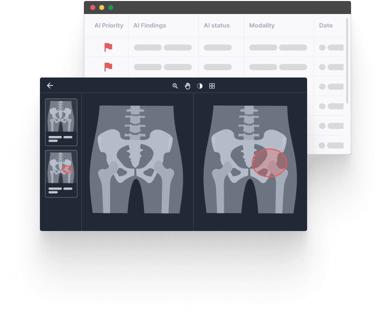 deepcOS for Radiologists