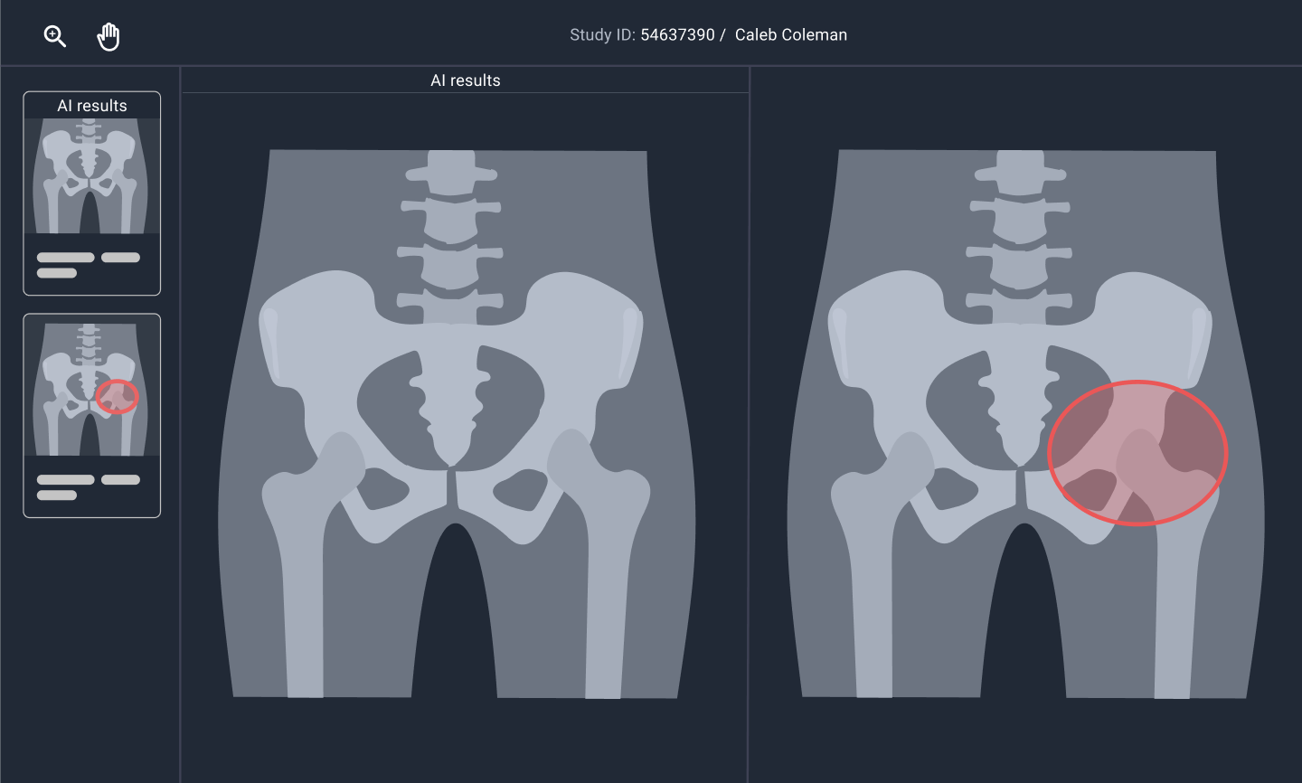 deepc blog: Can radiologists diagnose faster and more accurately ...