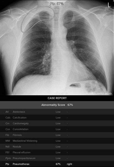 deepc blog: Artificial Intelligence for Chest X-Ray Transforming ...