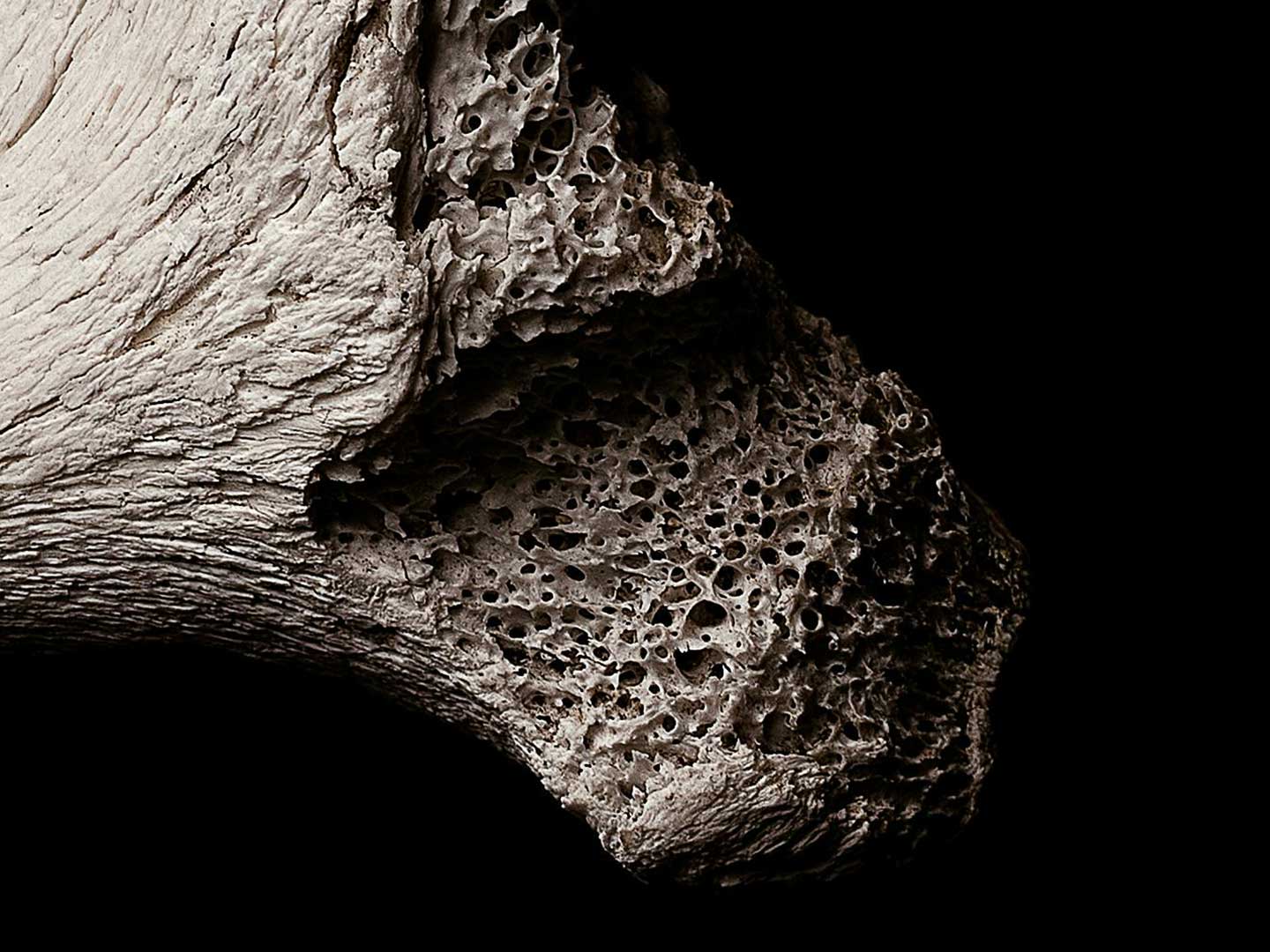 Advanced Metrology Methods For Porosity of 3D Porous Structures