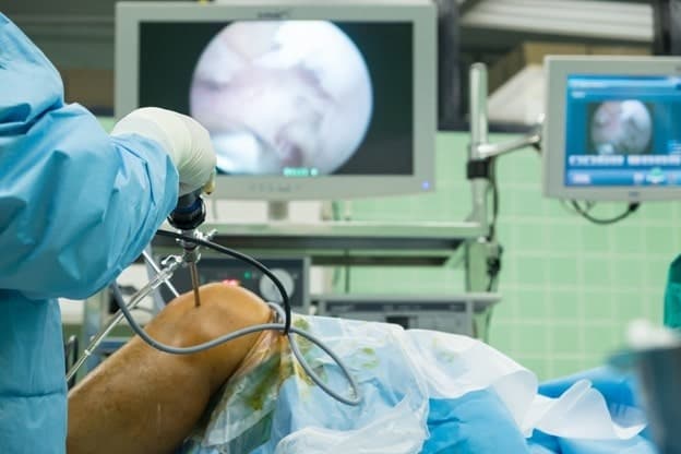 Atlanta Knee Arthroscopy Surgery