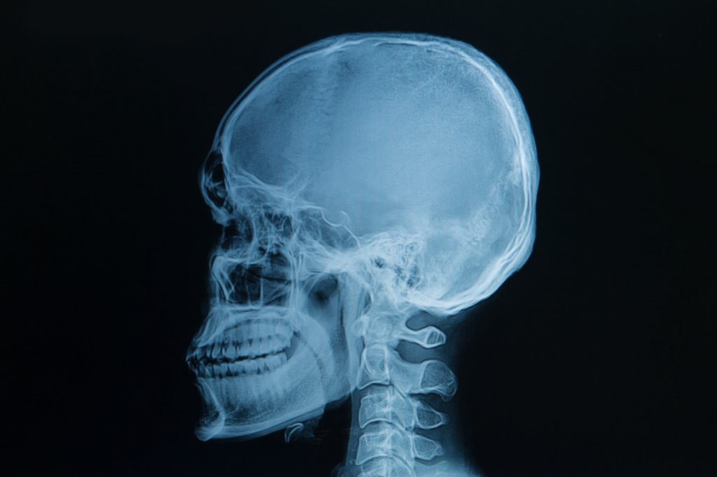 Three Types of Dental X-Rays - Midtown Dental Studio