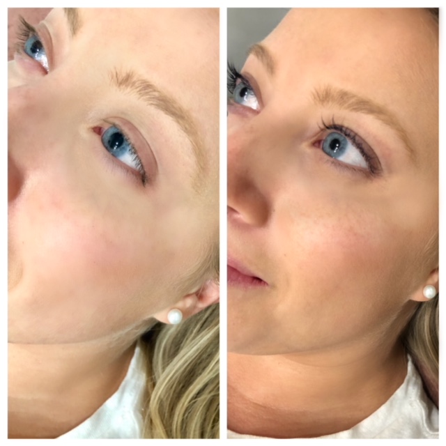 Get Longer Lashes with the RKS Lash Lift! | Roman K. Salon