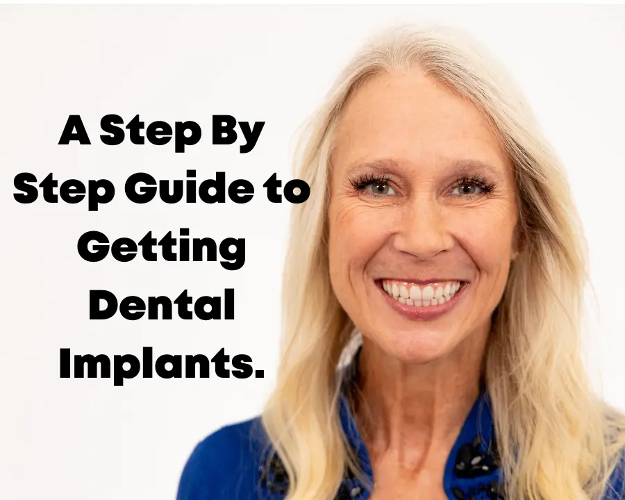 A Step-by-Step Guide to Getting Dental Implants: What to Expect