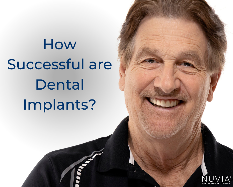 What You Need To Know About Full Mouth Dental Implants Success Rates
