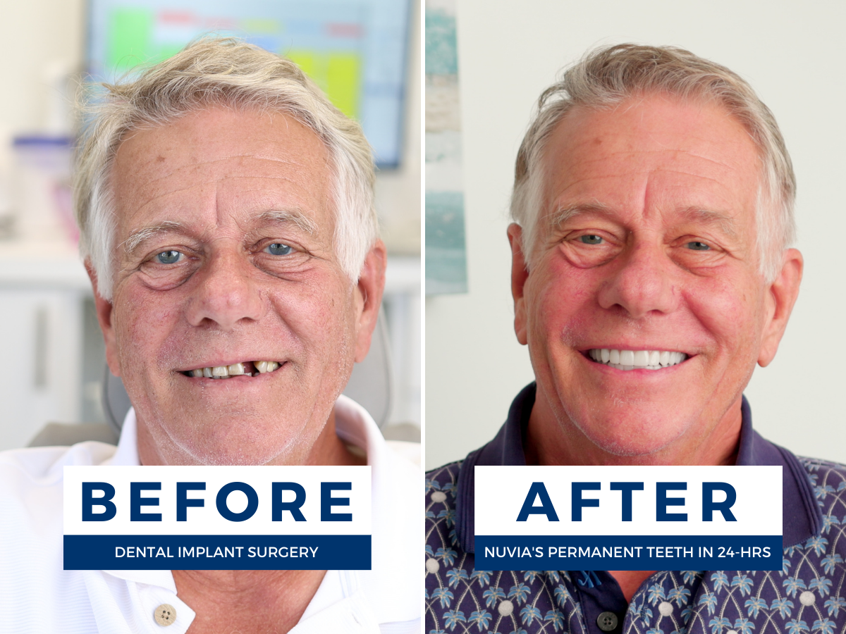 Dental Implants Post-Op Care and Support