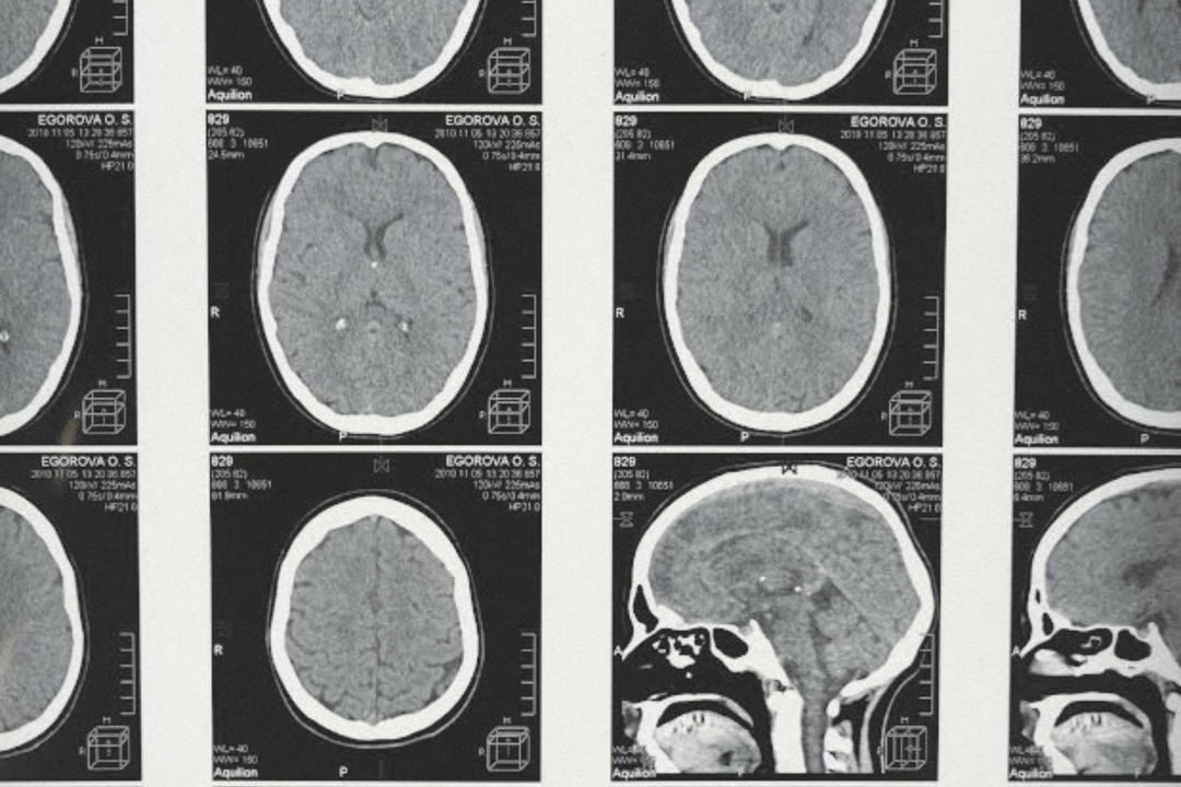 The Daily Drip | How Social Media Impacts the Brain