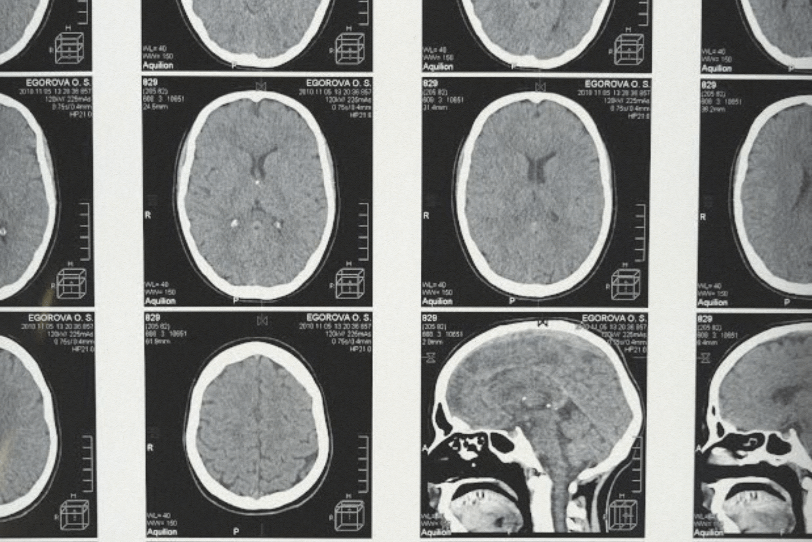 The Daily Drip | How Social Media Impacts the Brain