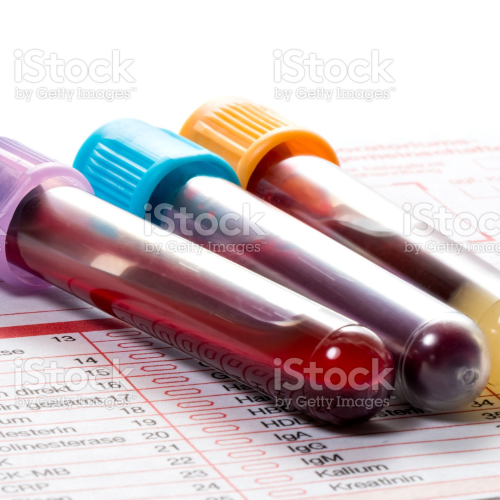 Animal Blood By-Products