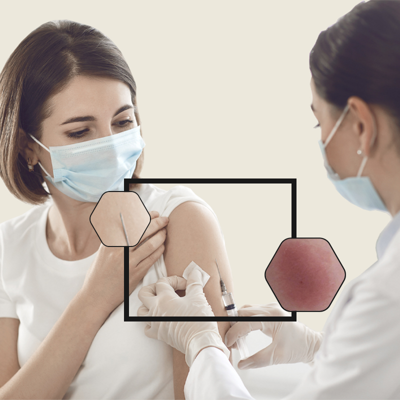 SCARLETRED - VACCINATION - Monitoring of injection site reactions