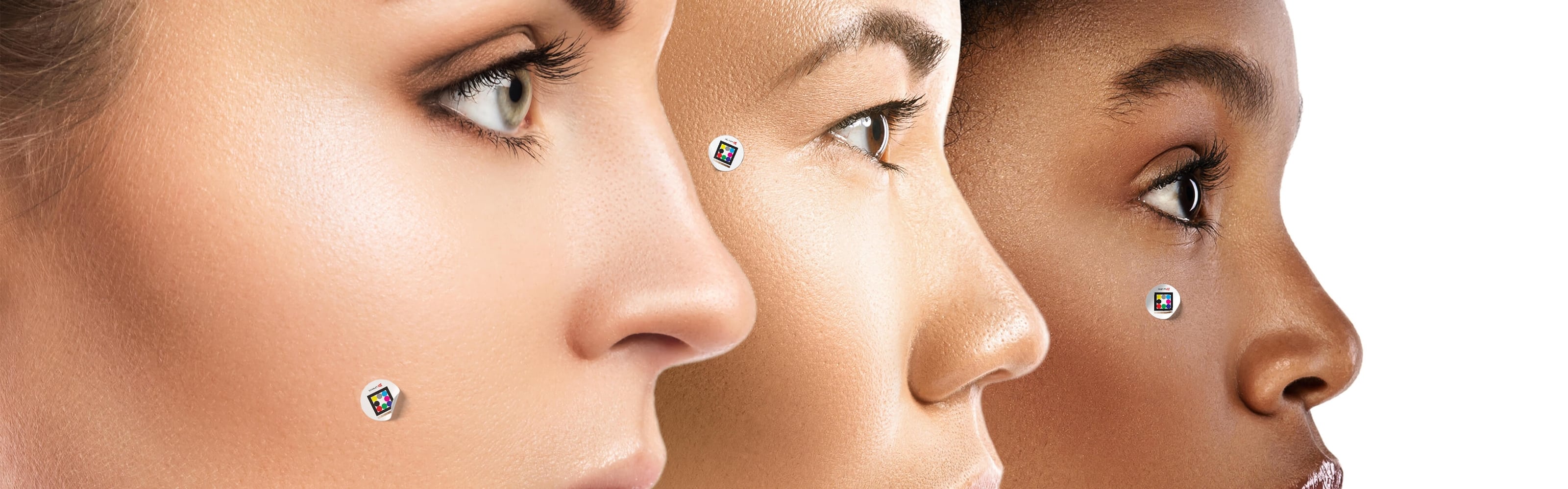SCARLETRED - Objective measurement of skin pigmentation disorders