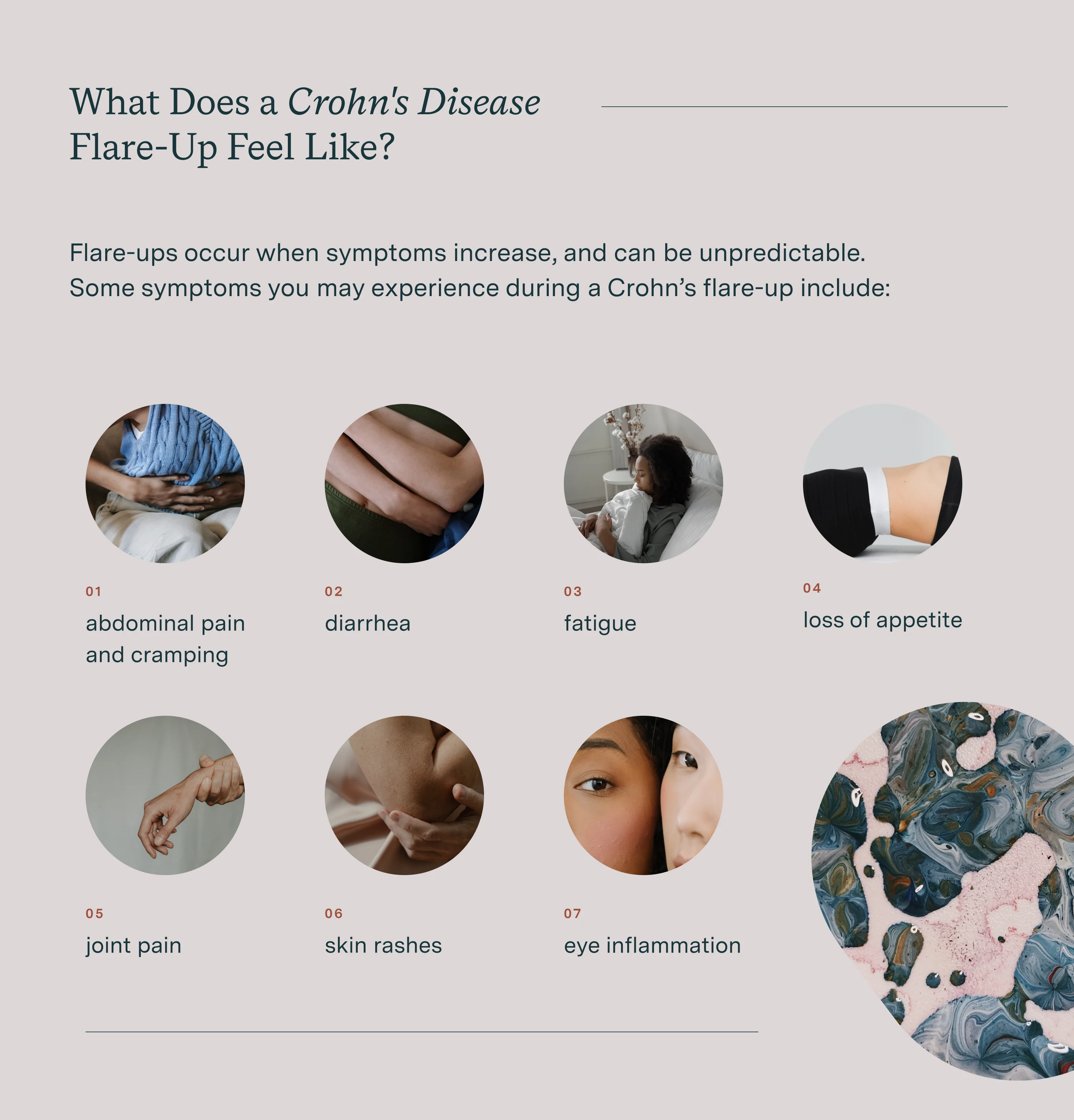 What Does a Crohn's Disease Flare-Up Feel Like?