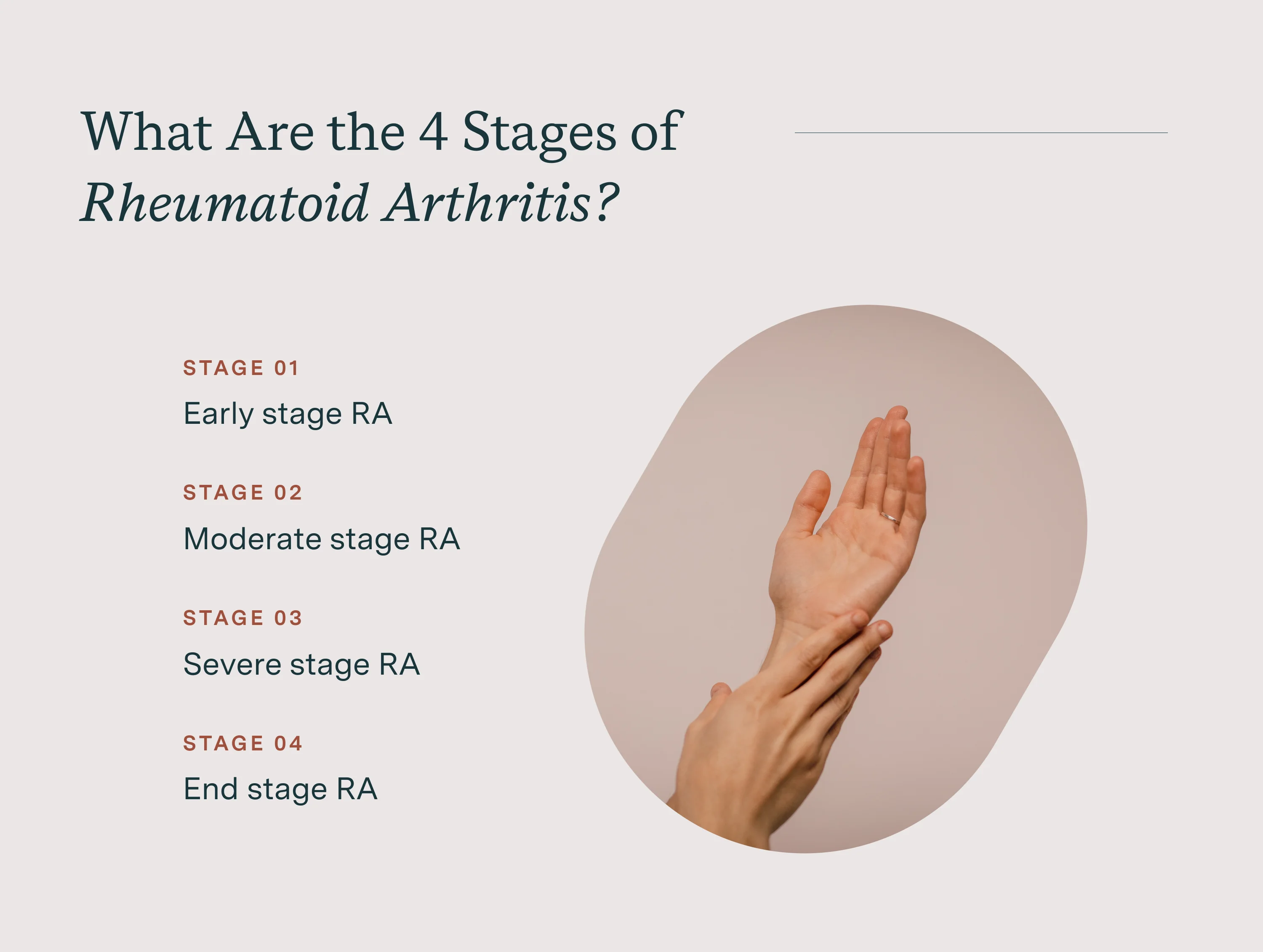 What Are The 4 Stages Of Rheumatoid Arthritis? A Complete Breakdown