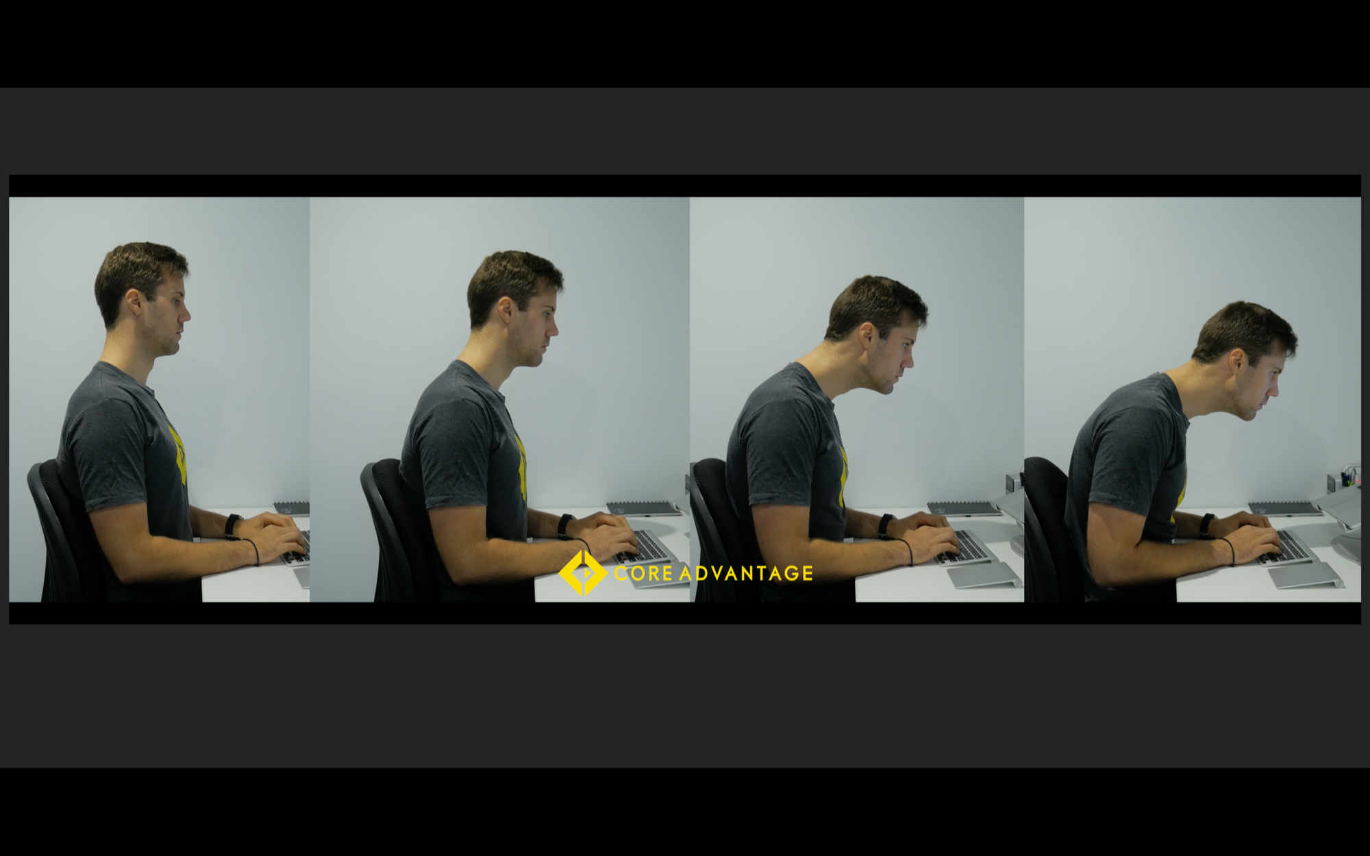 Biomechanics of the Spine - How Posture Influences our Structures - Blog