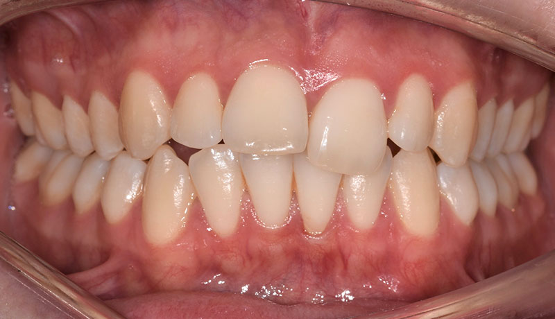 Orthodontics | Treatments | The Priestgate Clinic
