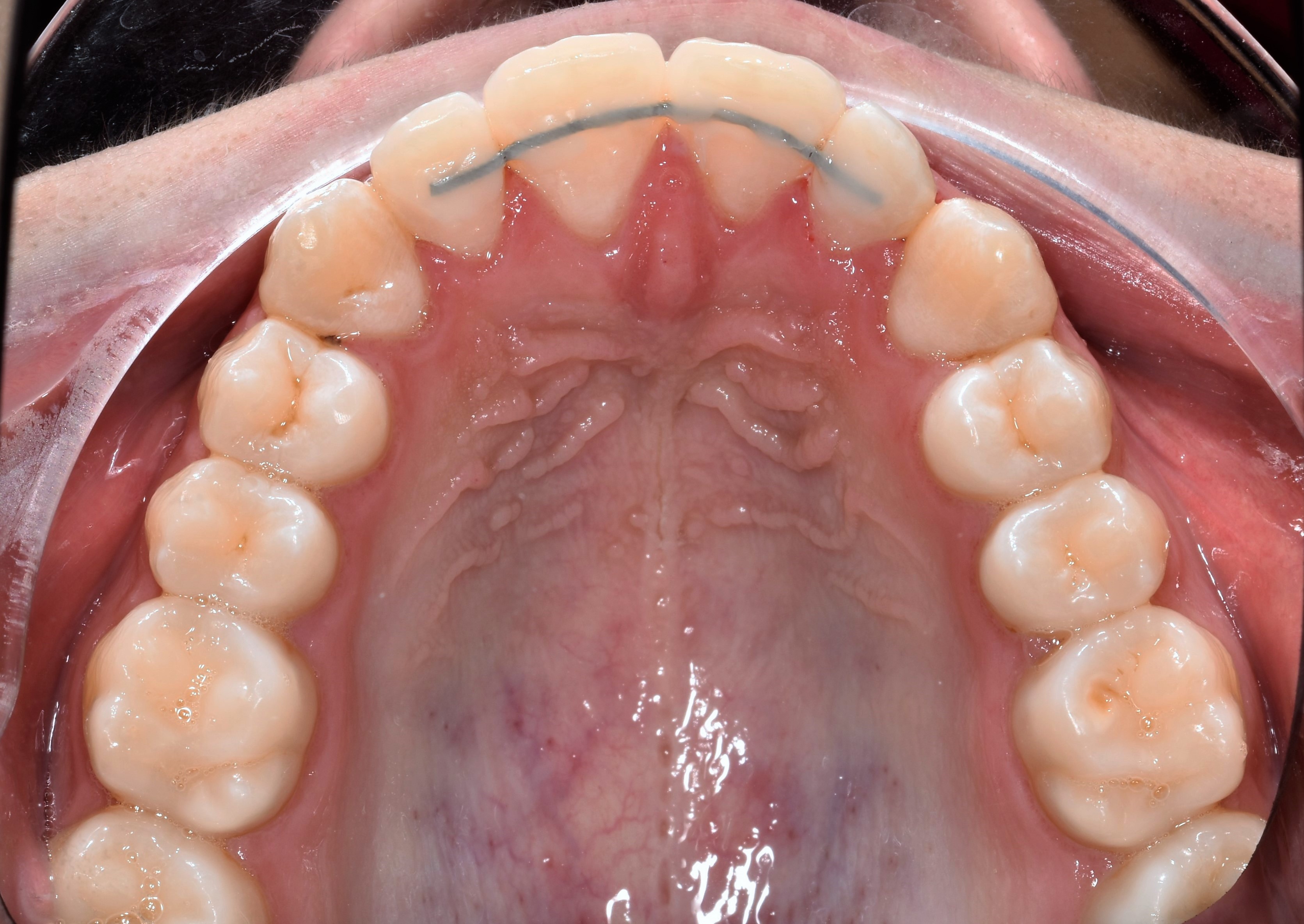 Orthodontics | Treatments | The Priestgate Clinic