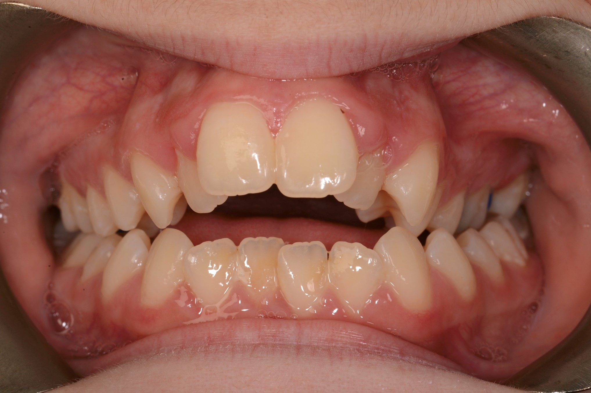 Orthodontics | Treatments | The Priestgate Clinic